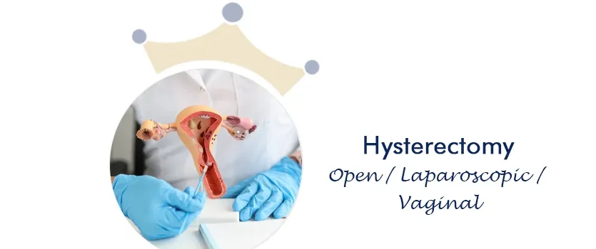 Best Hysterectomy Surgery Doctor in Ahmedabad | ADORN